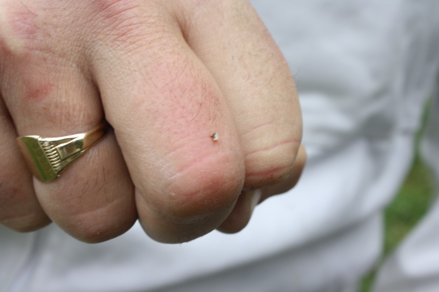 Are Bee Stings Good For You